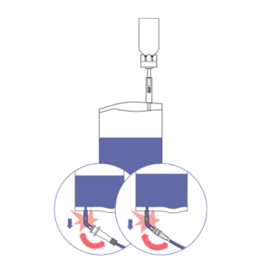 Bladder Cancer Care with Mitomycin | BC Care